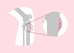 afabicin (Debio 1450) - Debiopharm